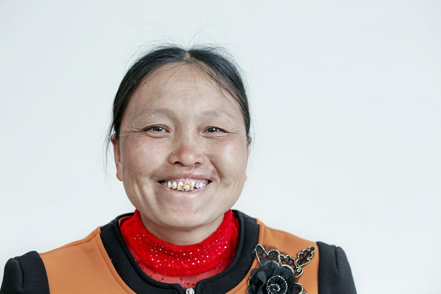 Nunca Es Tarde - Operation Smile Espanol