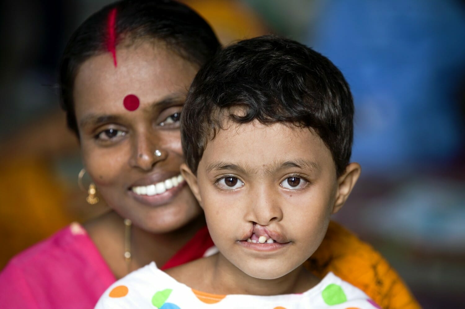 El Propósito De Rikta - Operation Smile Espanol