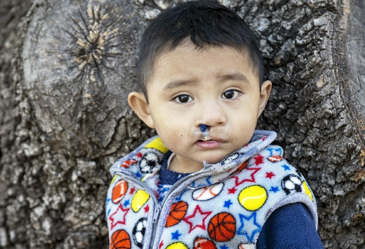 La Felicidad Completa - Operation Smile Espanol