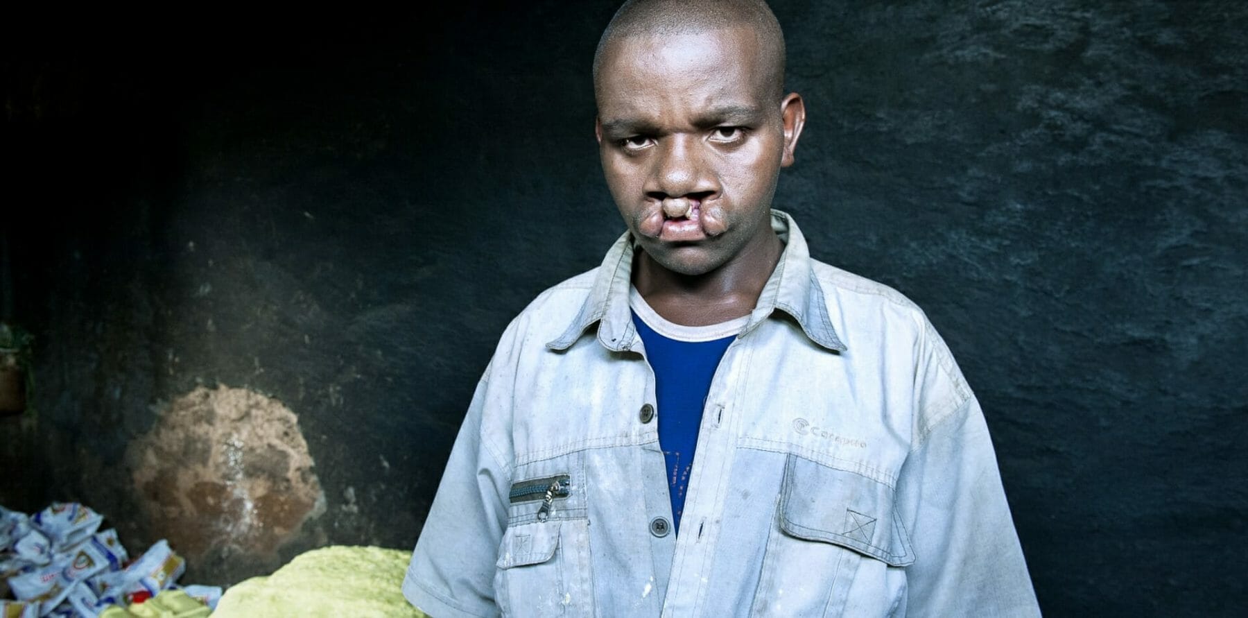 La Responsabilidad De Todos - Operation Smile Espanol